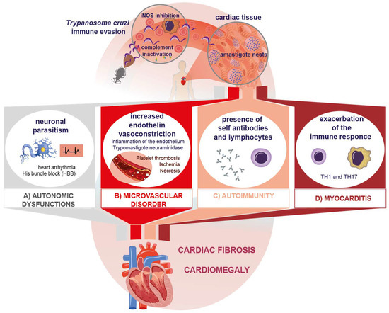 Immunopathological Mechanisms Underlying Cardiac Damage in Chagas Disease