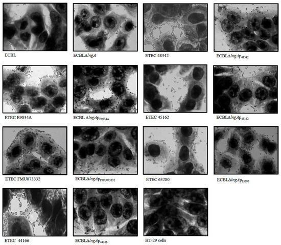 Recombinant Escherichia coli BL21 with LngA Variants from ETEC E9034A ...