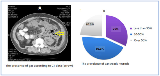 Pancreatic Necrosis Infection as a Determinant of Multiple Organ ...