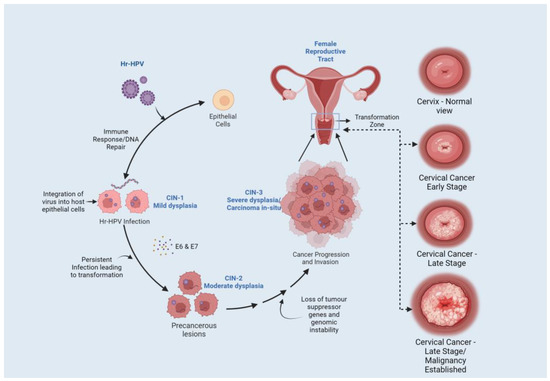 Human Papilloma Virus: An Unraveled Enigma of Universal Burden of Malignancies