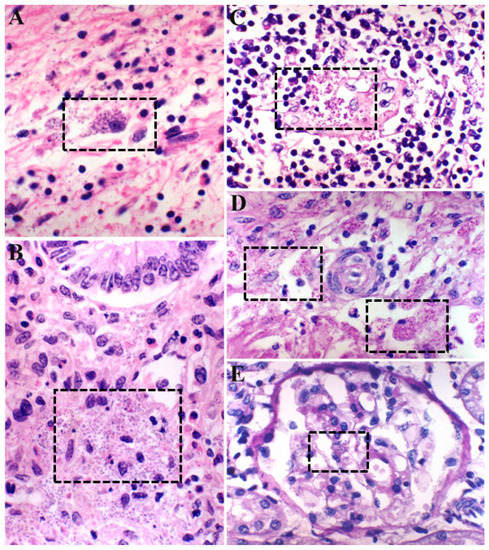 Central Nervous System Histoplasmosis: An Updated Insight