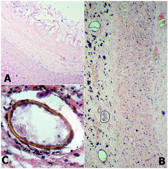 Hatchability of Fascioloides magna Eggs in Cervids