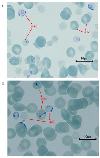 Pathogens | Free Full-Text | Babesia divergens Shows Equal Predilection ...