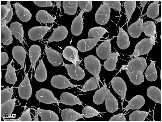 Giardiase Ultrastructural Alterations Of The Human Pathogen Giardia