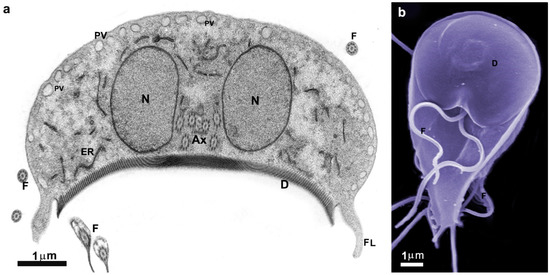 Ultrastructural Alterations of the Human Pathogen Giardia intestinalis ...