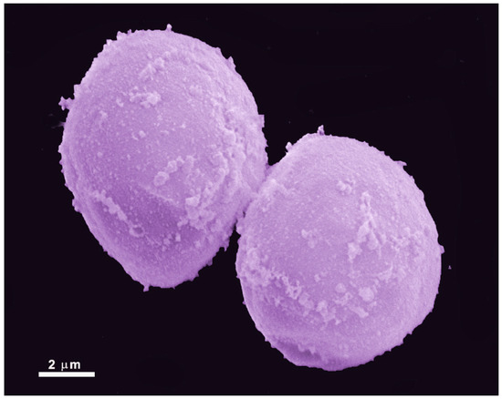 Ultrastructural Alterations of the Human Pathogen Giardia intestinalis ...