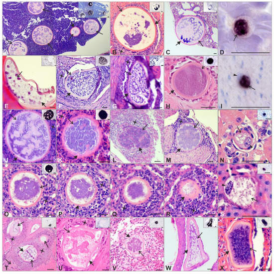 Comparative Analysis of the Exo-Erythrocytic Development of Five ...