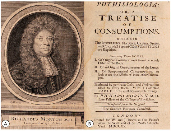 Brain Tuberculosis: An Odyssey through Time to Understand This Pathology