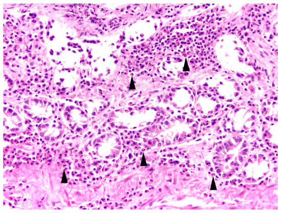 Pathomorphological Findings and Infectious Diseases in Selected ...