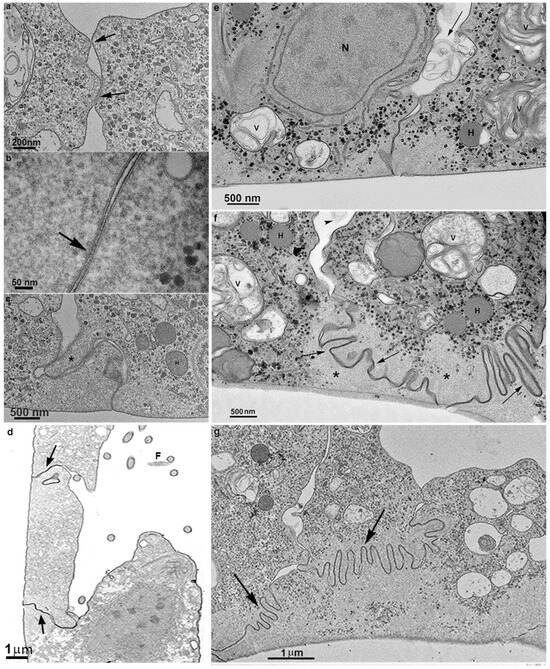 Trichomonas vaginalis: Monolayer and Cluster Formation—Ultrastructural ...