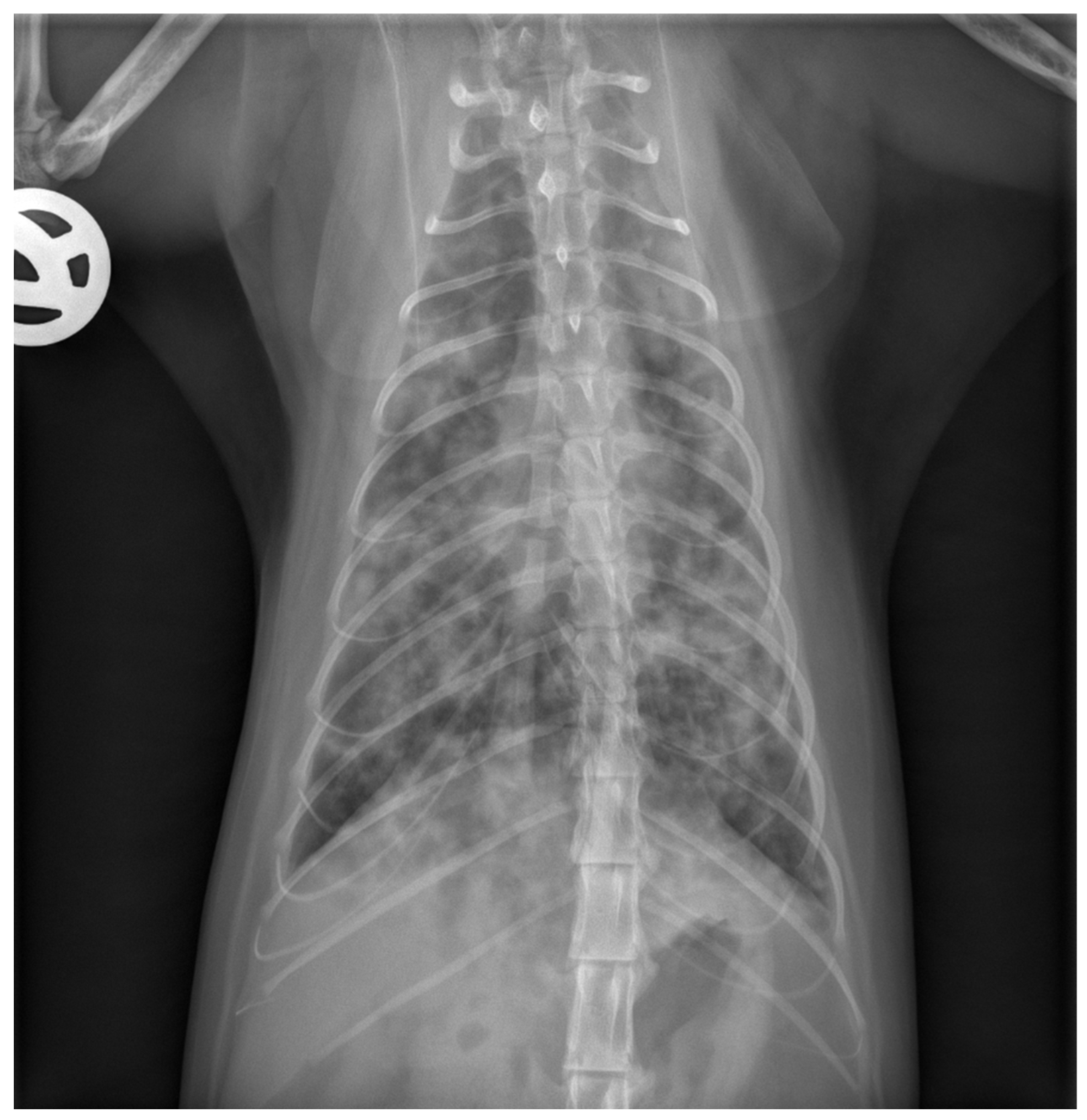 Fulminant Pneumonia Due to Reactivation of Latent Toxoplasmosis in a ...