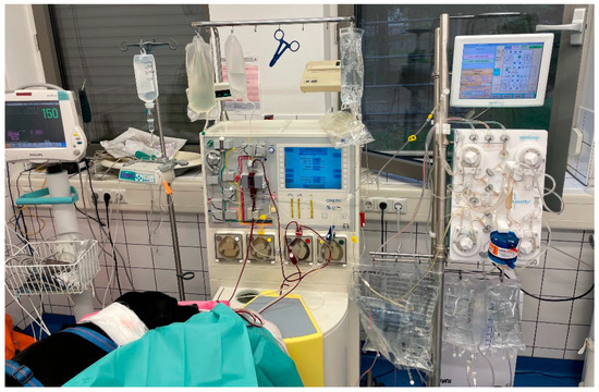 Supportive Treatment of a Dog with Leishmaniosis and Severe ...