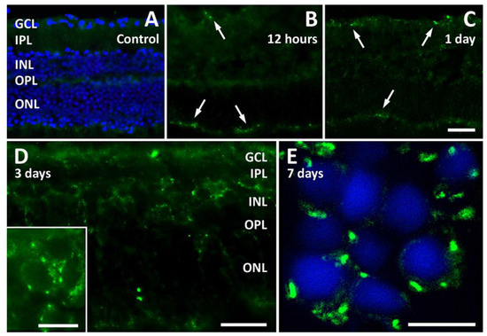 A New Ex Vivo Model Based on Mouse Retinal Explants for the Study of ...