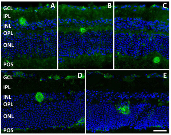 A New Ex Vivo Model Based on Mouse Retinal Explants for the Study of ...