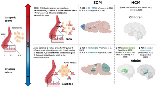 Contribution of Magnetic Resonance Imaging Studies to the Understanding ...