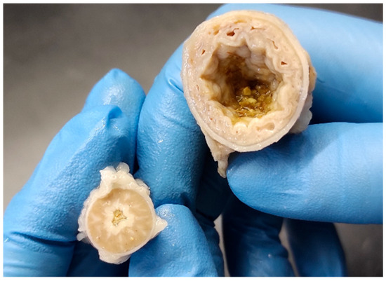 Transmissible Viral Proventriculitis in Broiler Chickens from Bosnia ...