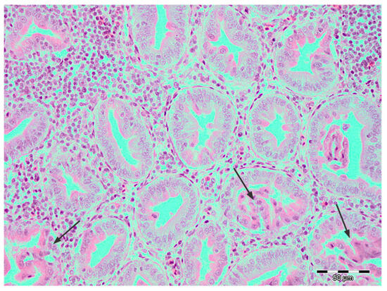 Transmissible Viral Proventriculitis in Broiler Chickens from Bosnia ...