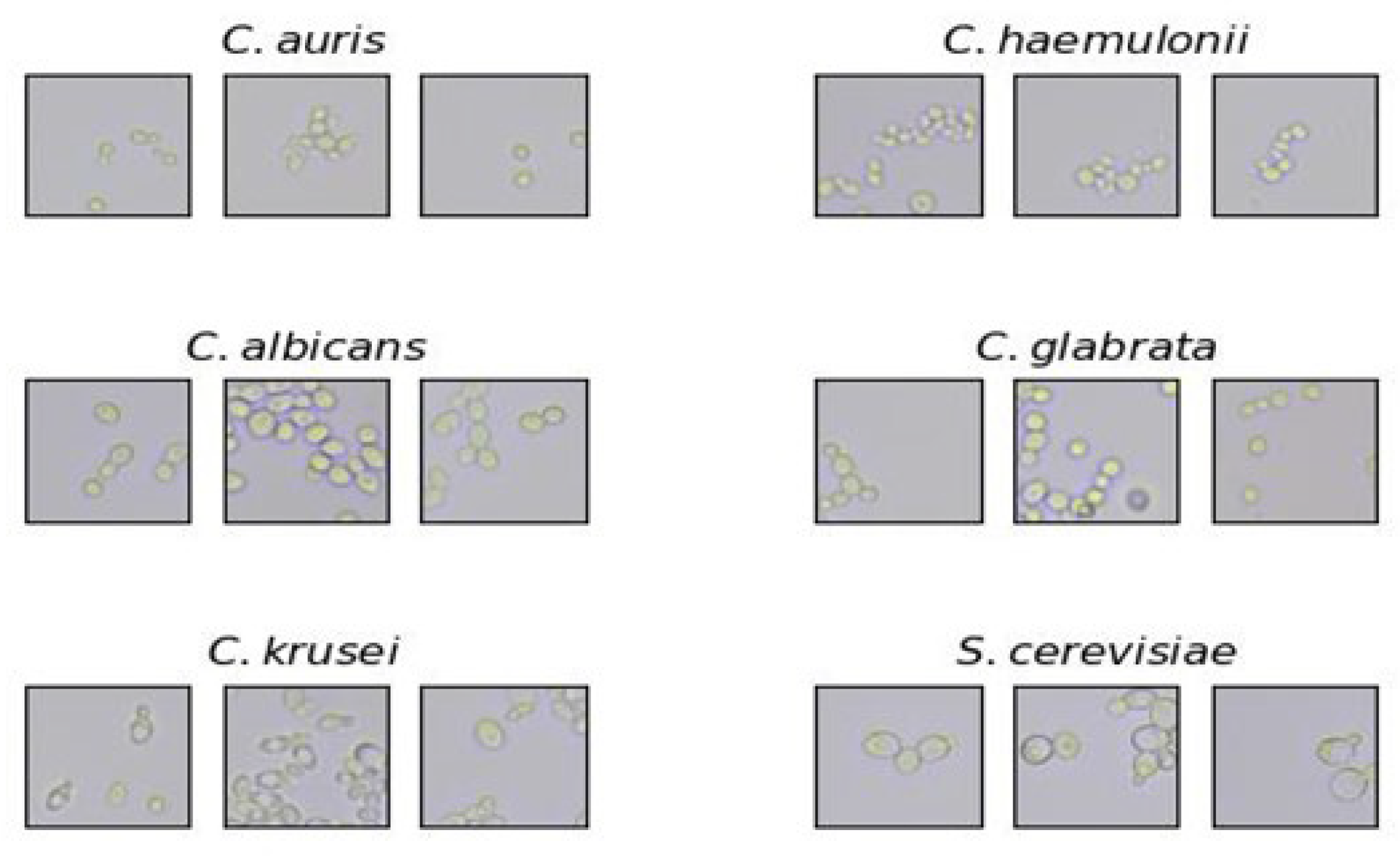 A Complete Transfer Learning-Based Pipeline for Discriminating Between ...