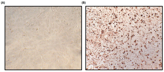 Cloning and Expression of a Truncated Form of the p72 Protein of the ...