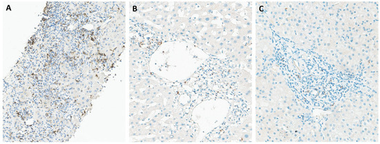 Immunohistochemical Profiling of Immune Checkpoints in Chronic ...