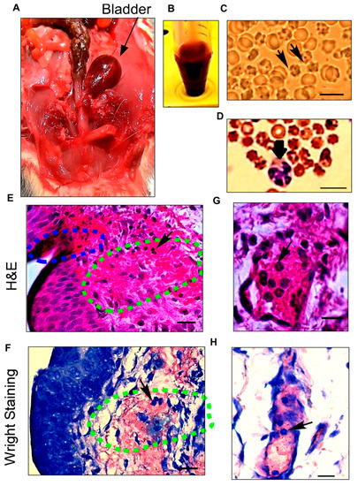 Sex Differences in Immune Cell Infiltration and Hematuria in SCI ...