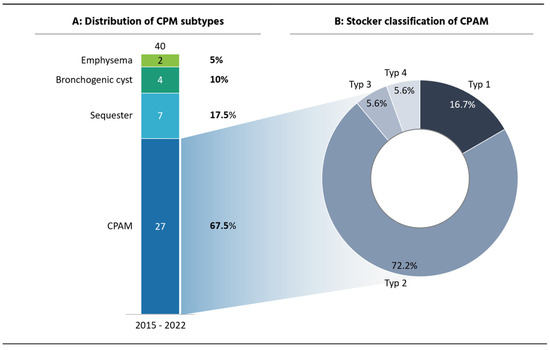 A Series of 40 Congenital Lung Malformation Cases and the Informative ...