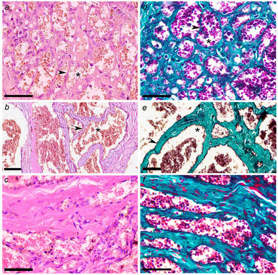 Histopathological Study of Canine Skin Hemangiomas and Hemangiosarcomas ...