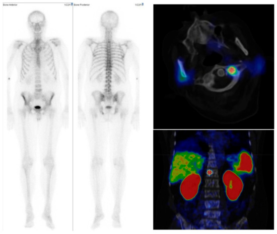 Pharmaceuticals | Special Issue : Emerging Theranostic Tracers in the ...