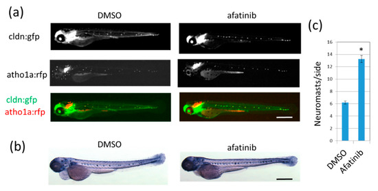Bucillamine Prevents Afatinib-Mediated Inhibition of Epidermal Growth ...