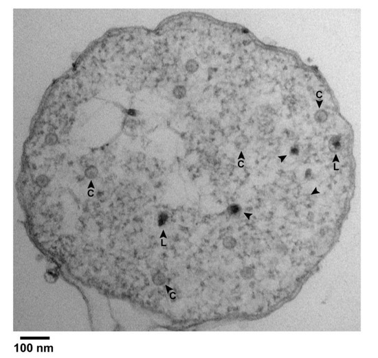 Electron Microscopy of In-Plaque Phage T3 Assembly: Proposed Analogs of ...