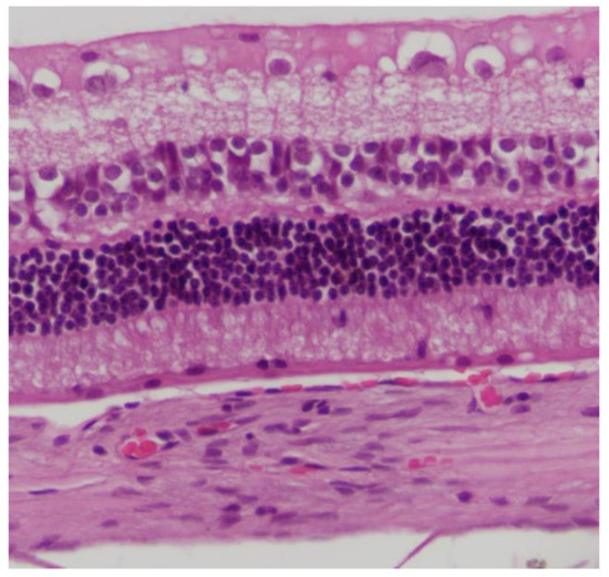 Histological Effects of Intravitreal Injection of Antifungal Agents in ...