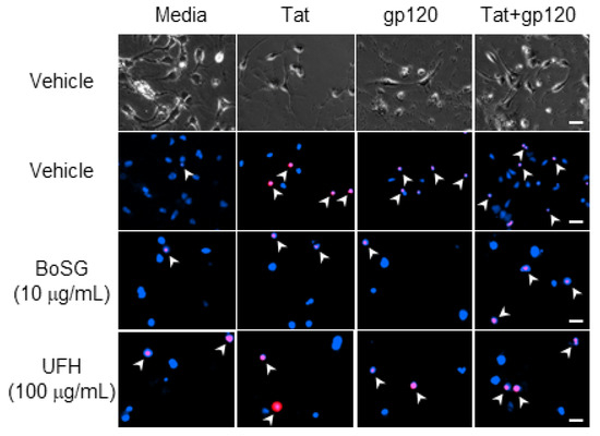 Red Algal Sulfated Galactan Binds and Protects Neural Cells from HIV-1 ...