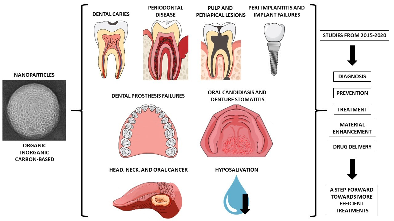 Pharmaceuticals | Free Full-Text | Nanoparticles in Dentistry: A ... Pharmaceuticals | Free Full-Text | Nanoparticles in Dentistry: A ...