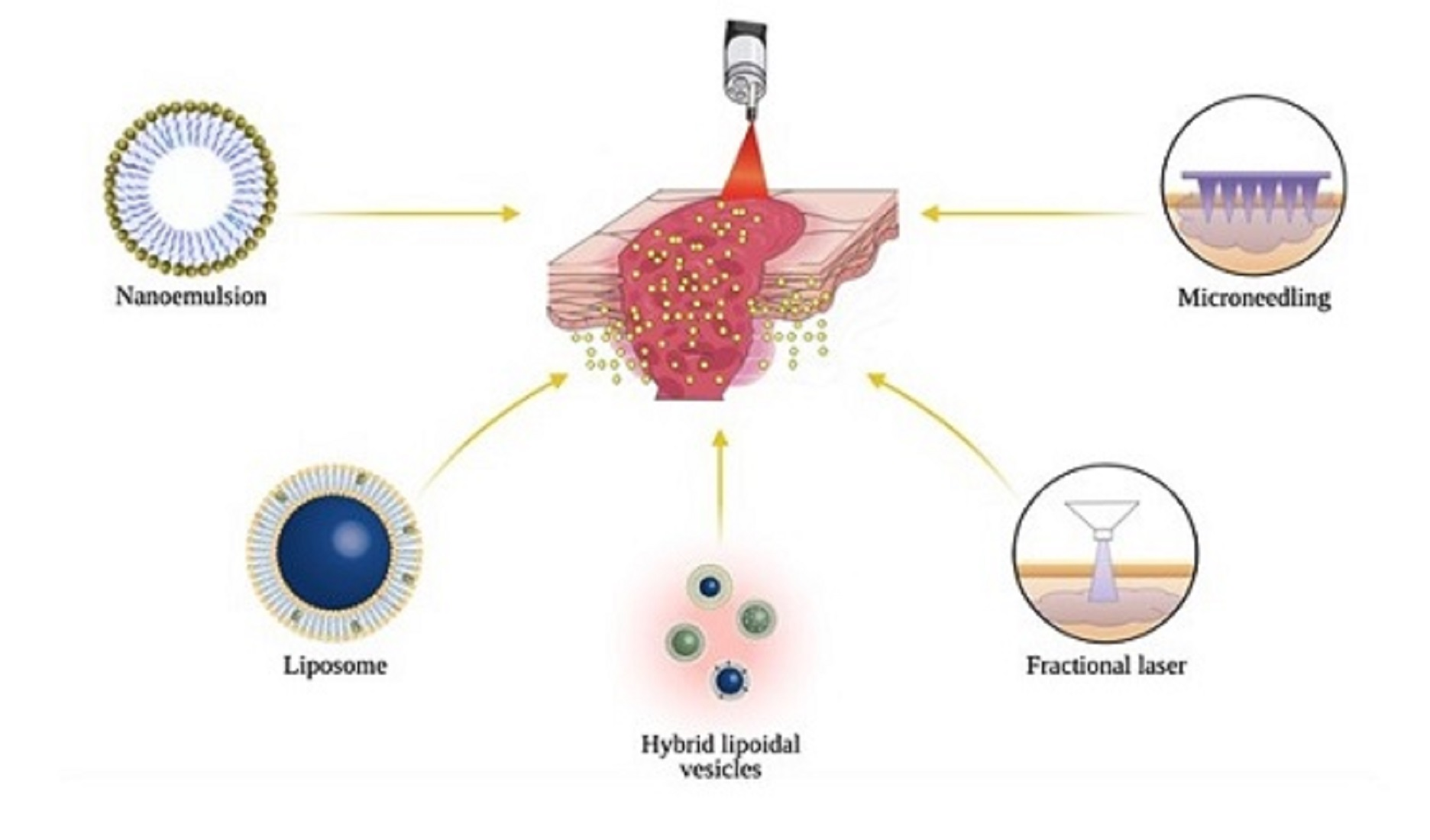 Pharmaceuticals | Free Full-Text | Micro- and Nano-Based Transdermal ...