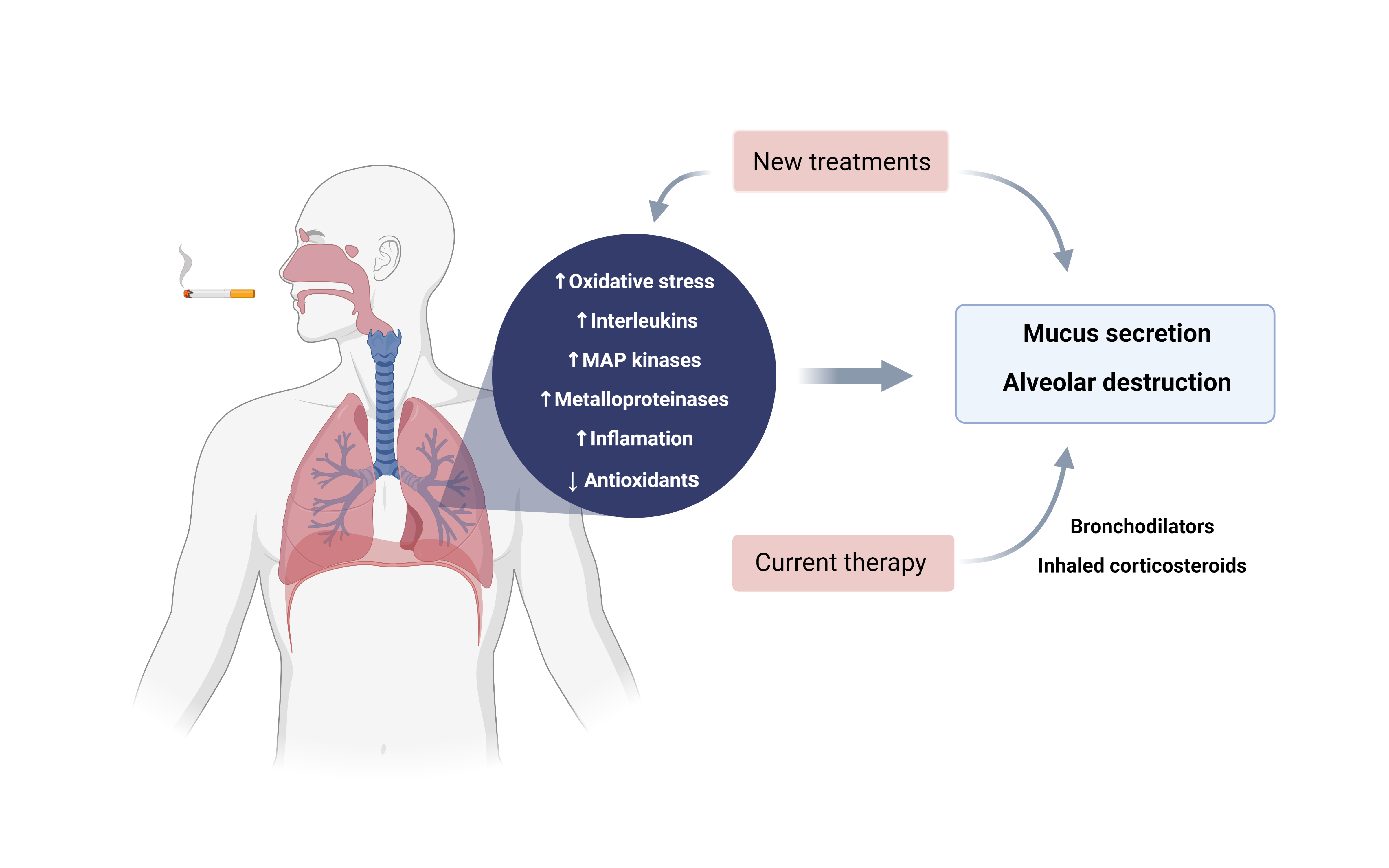 Pharmaceuticals | Free Full-Text | Mechanisms, Pathophysiology and ...