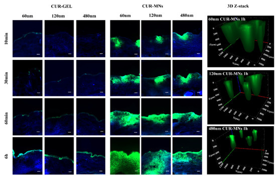 Particle Size Effect Of Curcumin Nanocrystals On Transdermal And