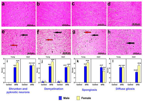 Experimental Evidence for Diiodohydroxyquinoline-Induced Neurotoxicity ...