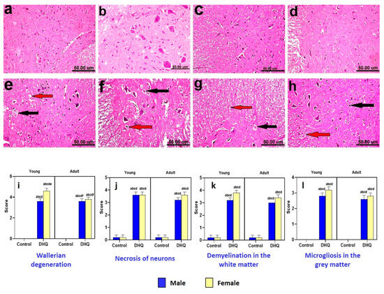 Experimental Evidence for Diiodohydroxyquinoline-Induced Neurotoxicity ...