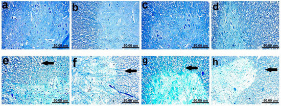 Experimental Evidence for Diiodohydroxyquinoline-Induced Neurotoxicity ...