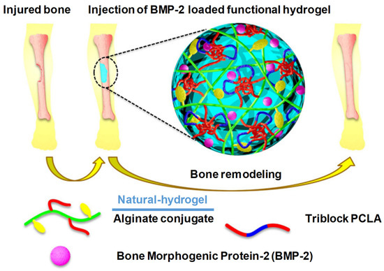 Current and Future Prospective of Injectable Hydrogels—Design ...