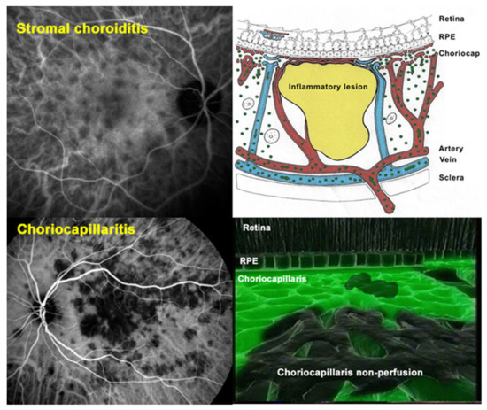 Mechanisms, Pathophysiology and Current Immunomodulatory ...