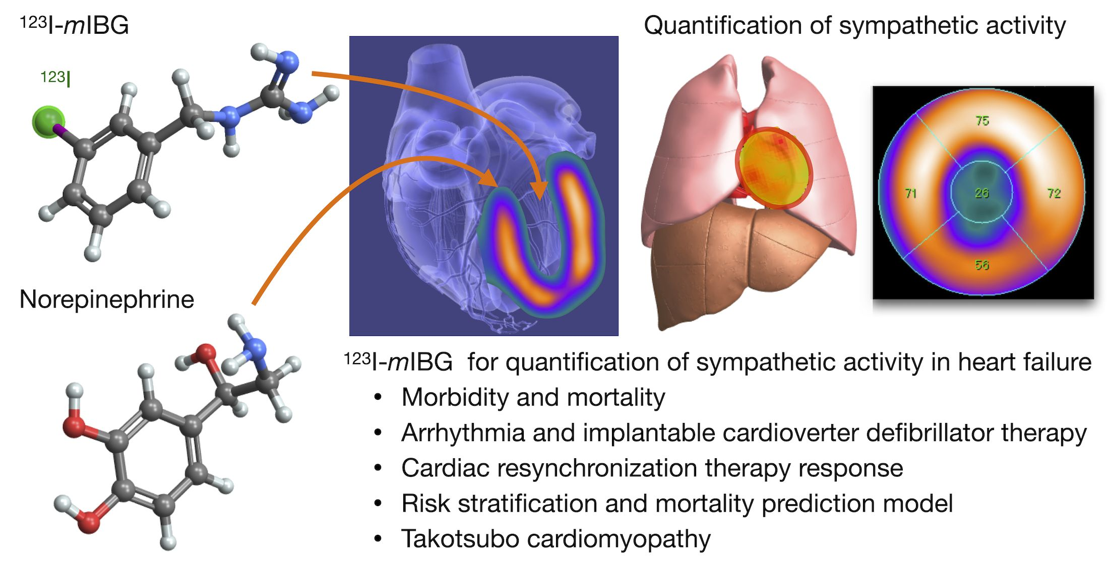 Pharmaceuticals | Free Full-Text | Cardiac 123I-mIBG Imaging in Heart ...