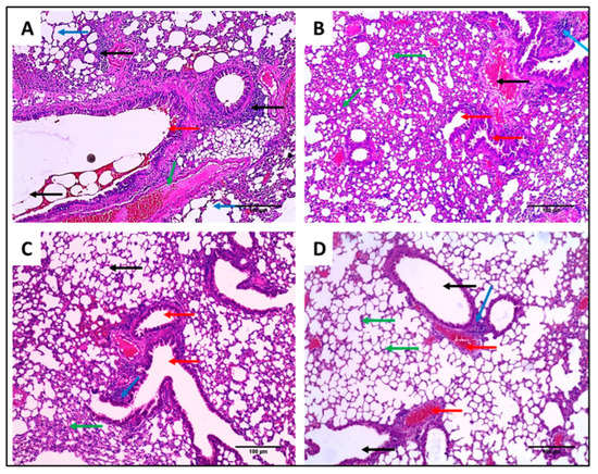 Bilosomes as Nanoplatform for Oral Delivery and Modulated In Vivo ...
