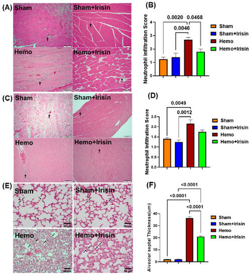 Irisin Preserves Cardiac Performance and Insulin Sensitivity in Response to Hemorrhage