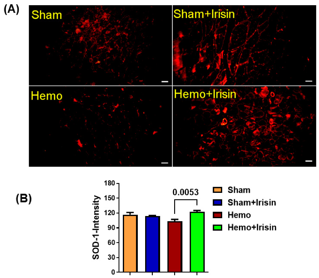 Irisin Preserves Cardiac Performance and Insulin Sensitivity in Response to Hemorrhage