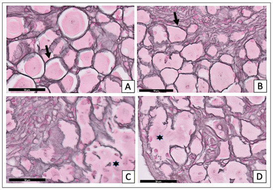 Neuroprotective Effect of Red Sea Marine Sponge Xestospongia ...