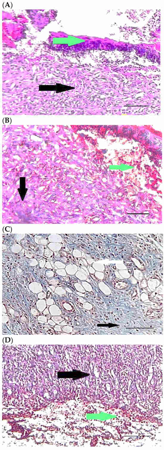 Pharmaceuticals | Free Full-Text | Preparation of Transdermal Patch ...