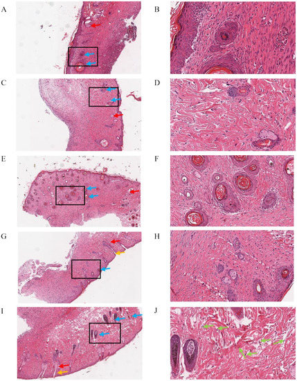 A Shape-Adaptive Gallic Acid Driven Multifunctional Adhesive Hydrogel ...