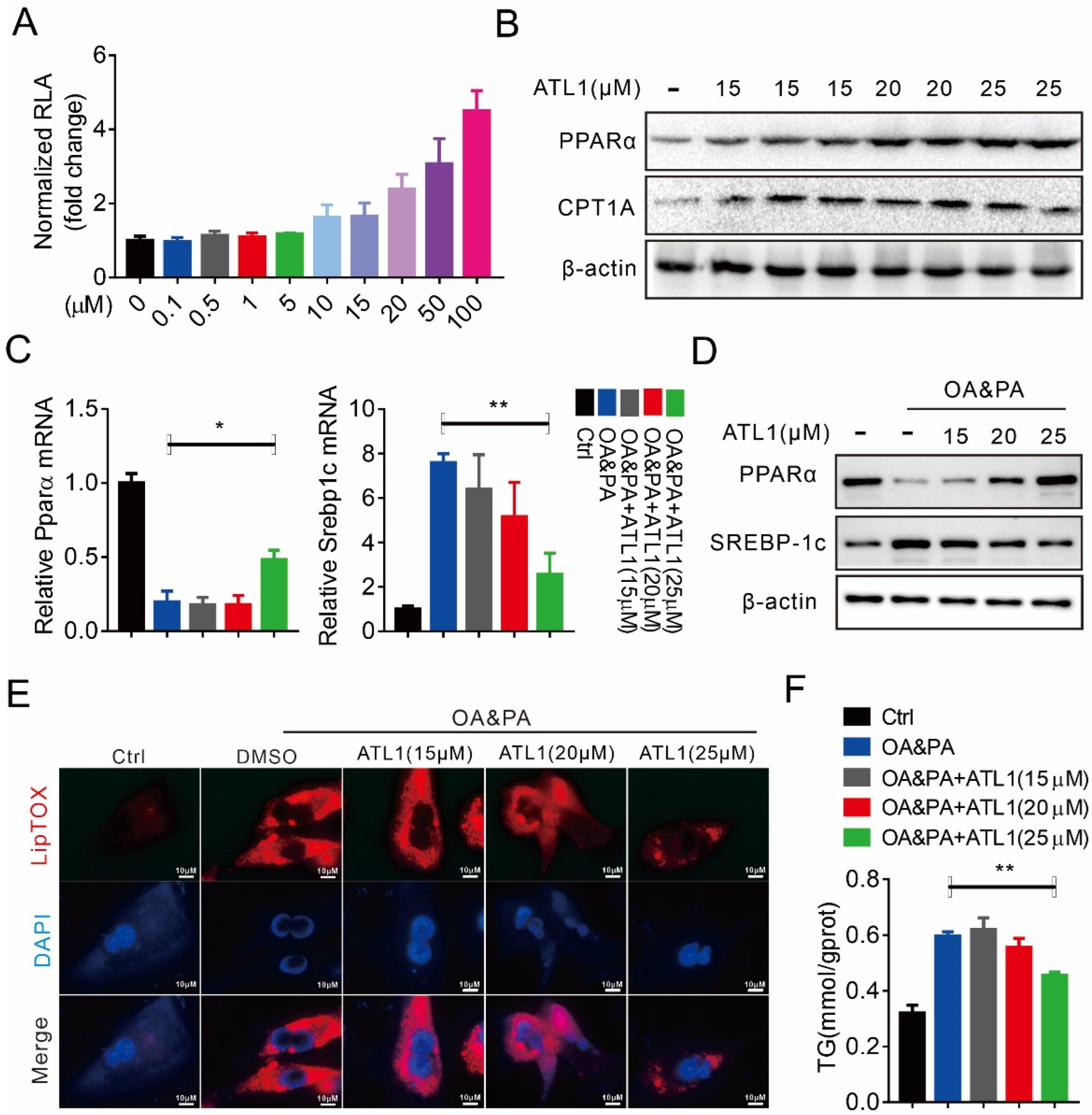 ATL I, Acts as a SIRT6 Activator to Alleviate Hepatic Steatosis in Mice ...