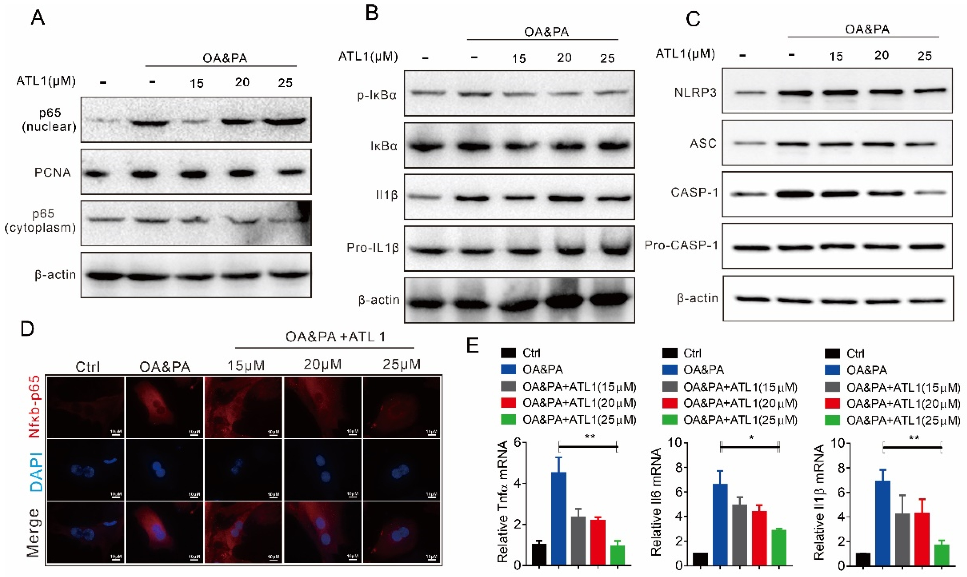 ATL I, Acts as a SIRT6 Activator to Alleviate Hepatic Steatosis in Mice ...